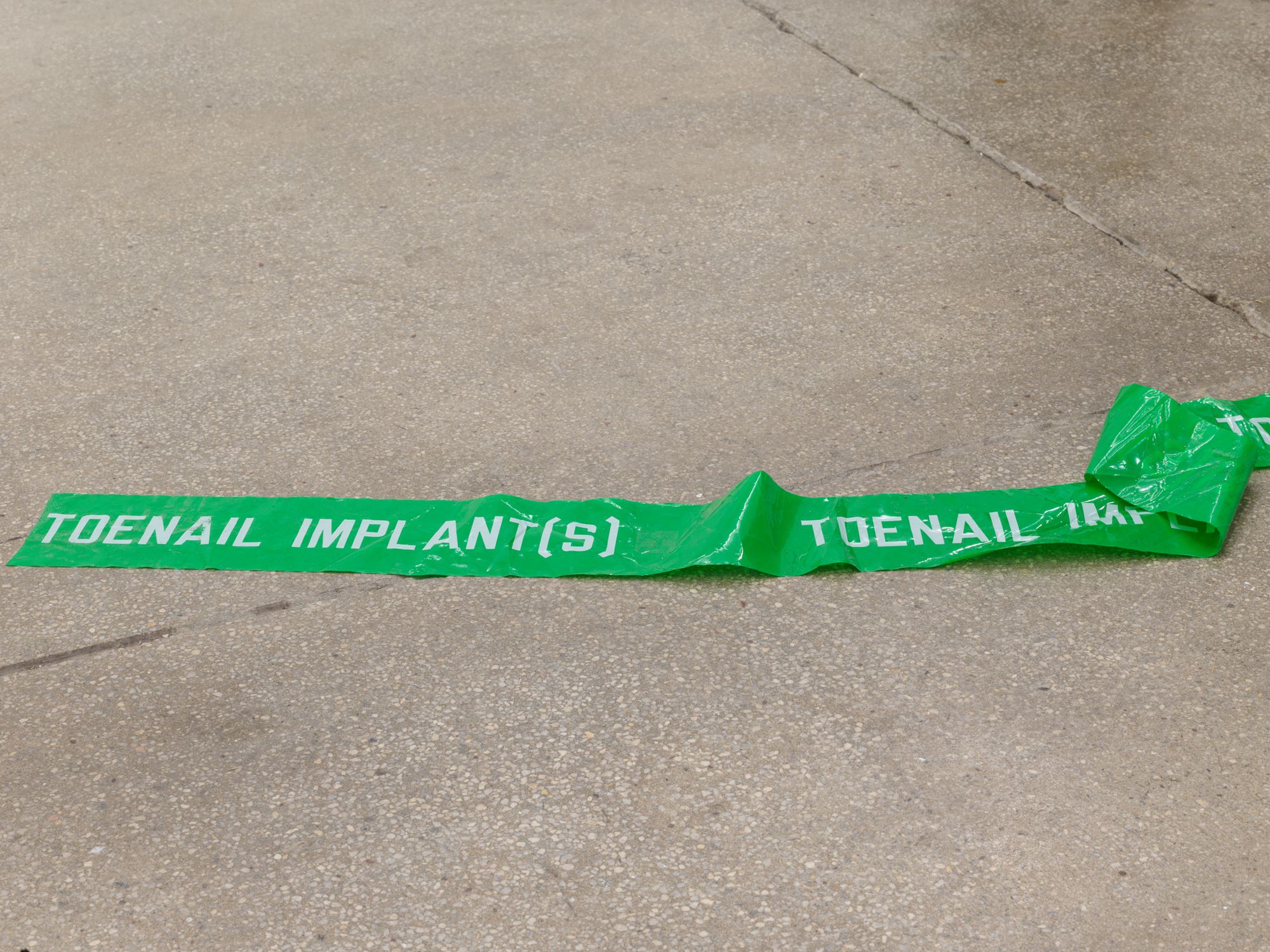 toenail implant(s) by Darren Bader | Ocula