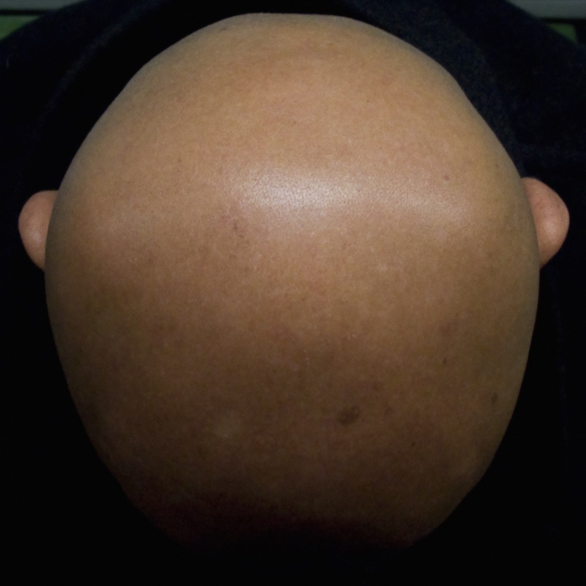 Liu Yue's Art For Sale, Exhibitions & Biography | Ocula Artist